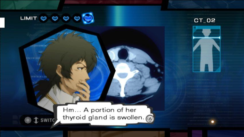 We Preview Trauma Team, Compliments of Atlus