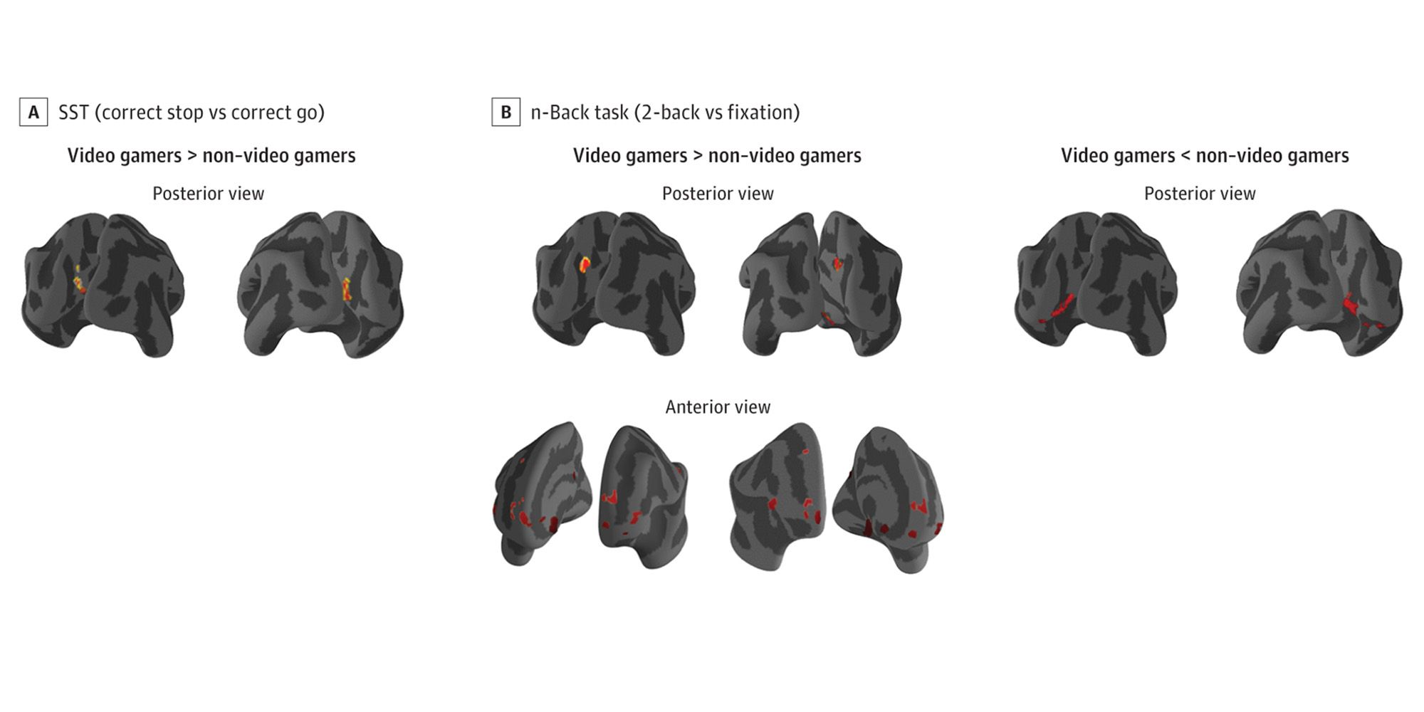 New Research Suggests Video Games Make Children Smarter